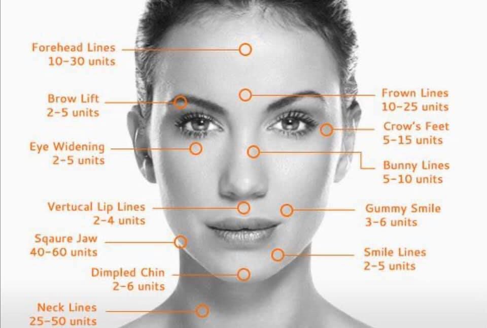 Botox | Medical spa 😍